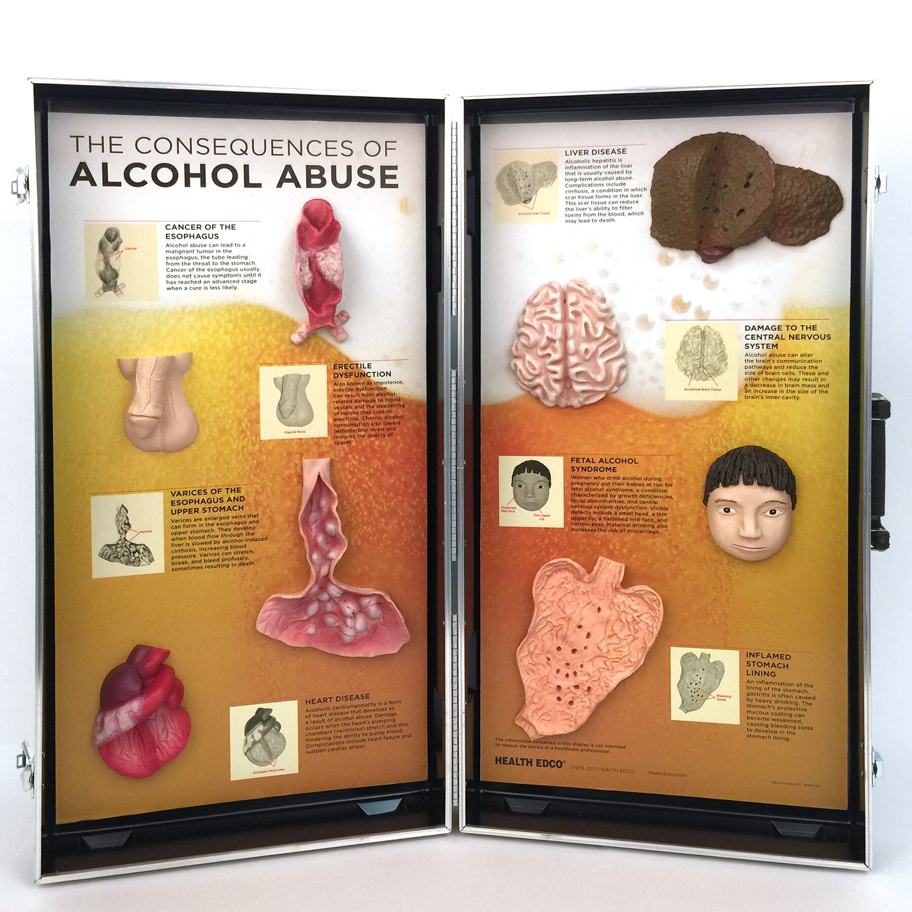 Alcohol and Your Liver | Alcohol Education | Health Edco