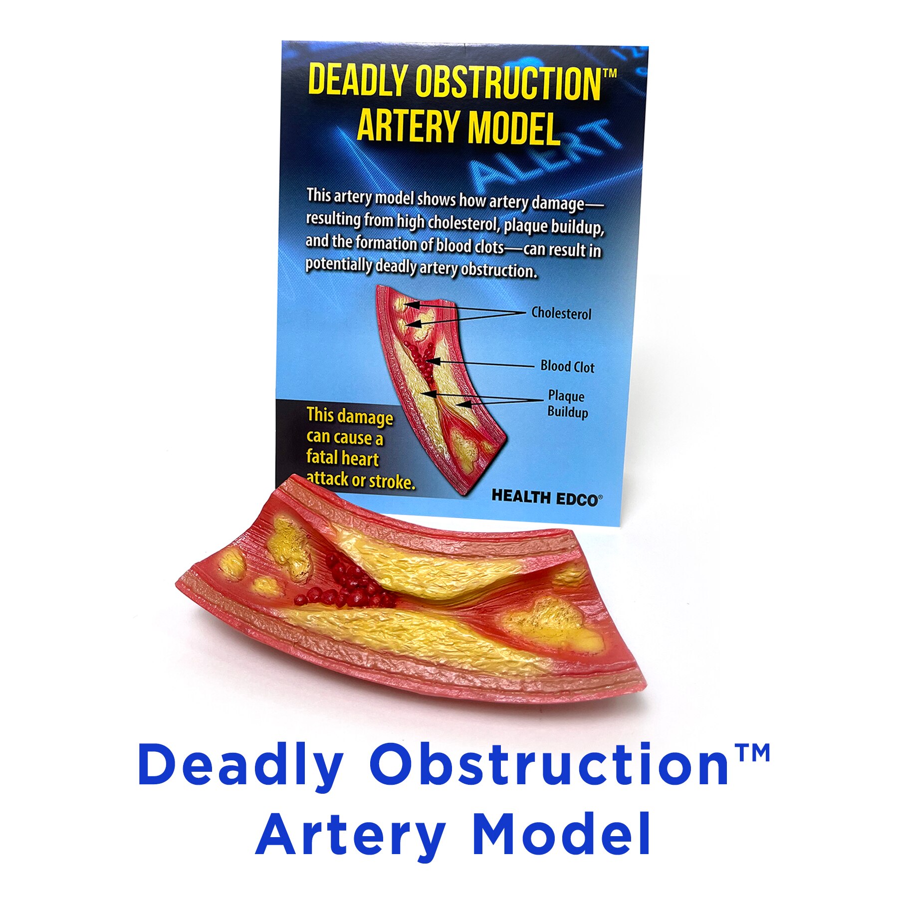 Stroke Facts | Cardiovascular Health Education | Health Edco