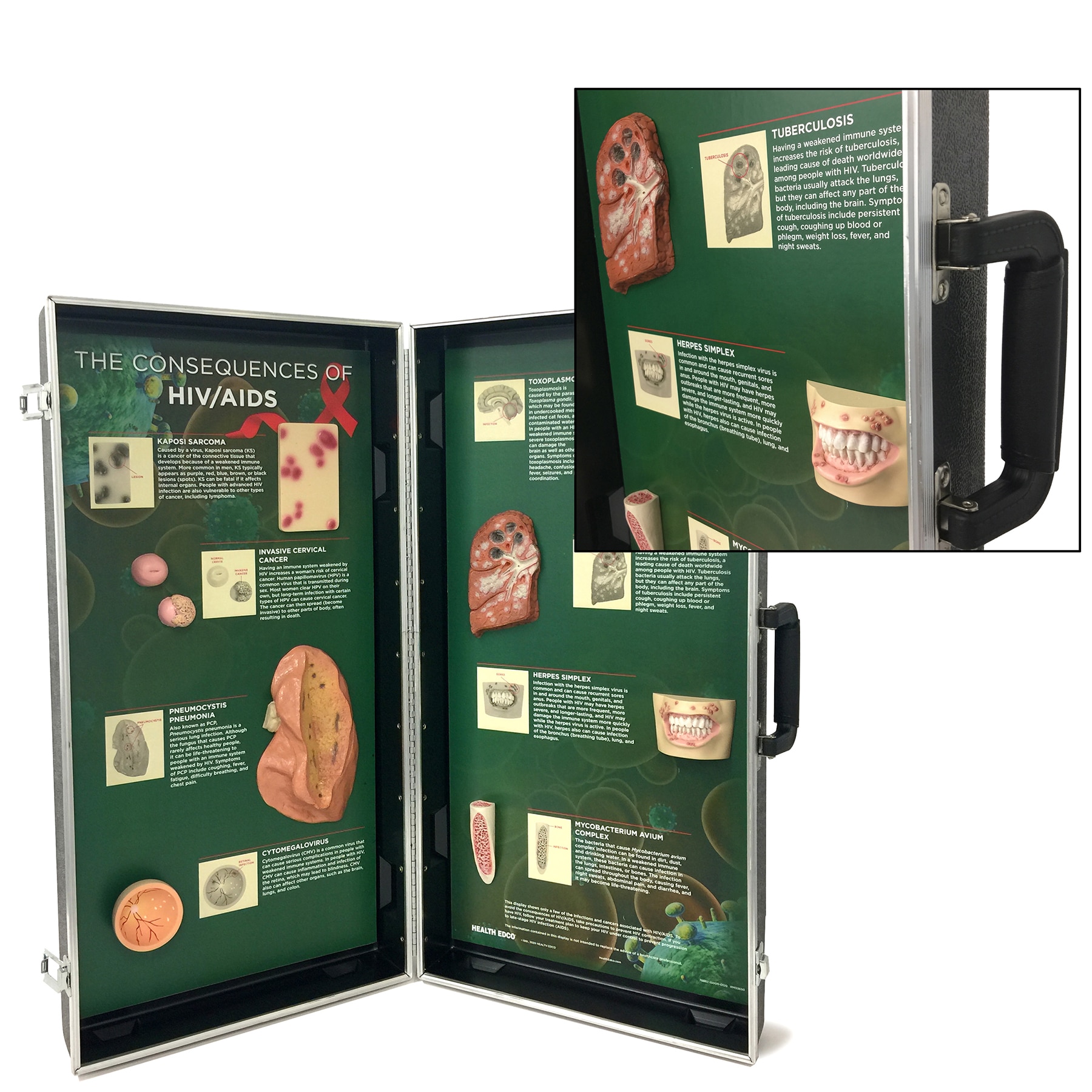 Health Education Consequences 3-D Displays | Health Edco