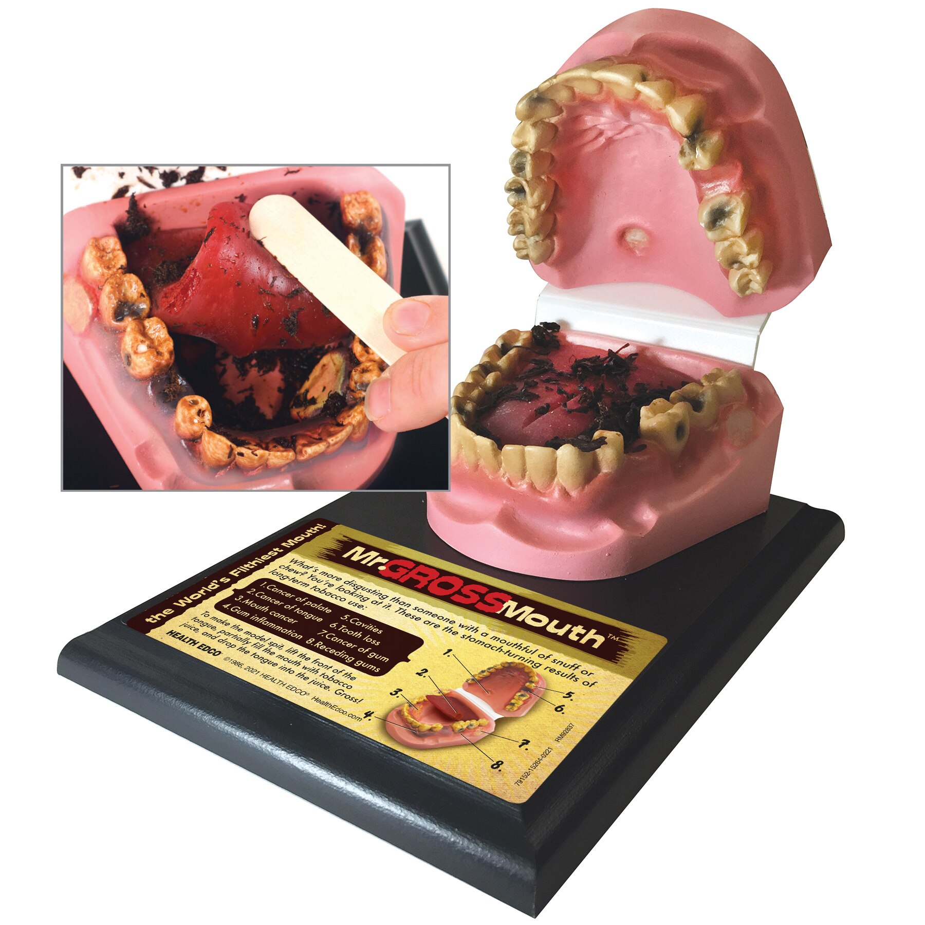 Health Edco Mouth Models for Health Education | Health Edco