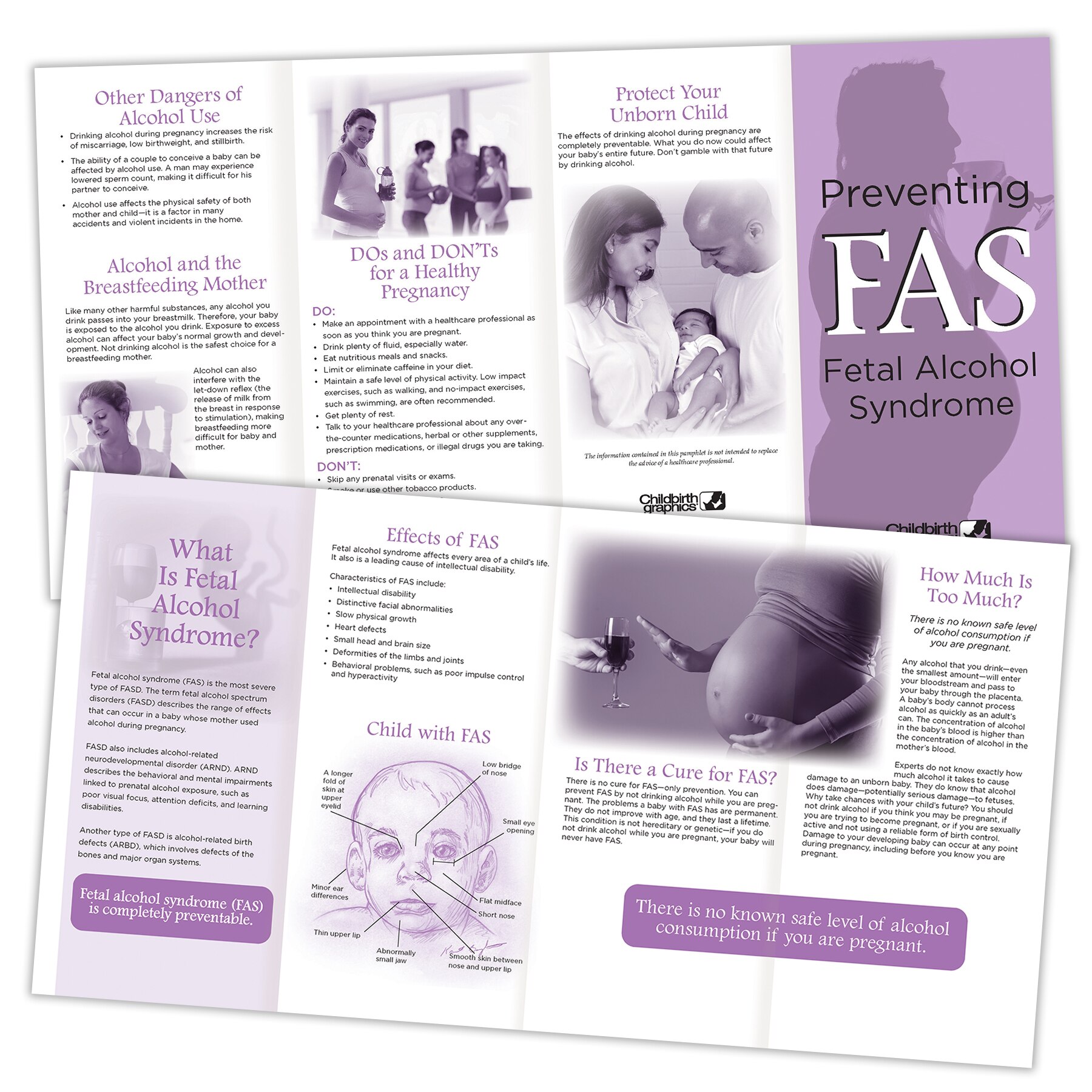 Fetal Alcohol Syndrome Poster Anavara International Fetal Alcohol