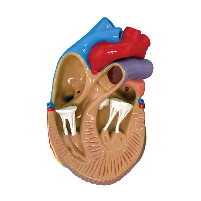 Heart Disease Model Set | Health Edco | Anatomical Models