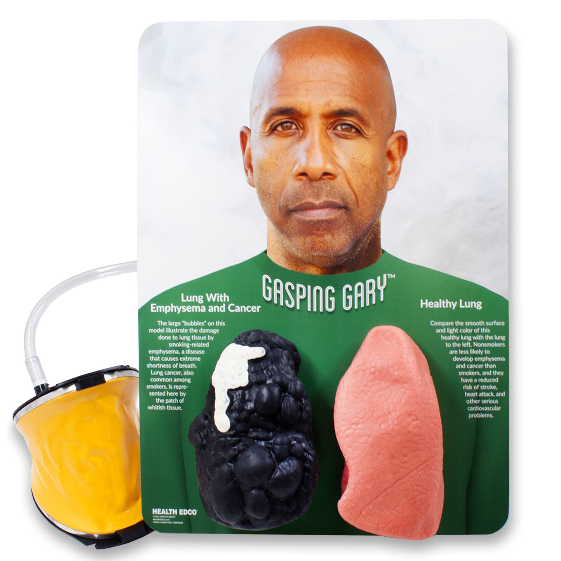 Gasping Gary™ Smoker's Lungs Comparison Model | Health Edco